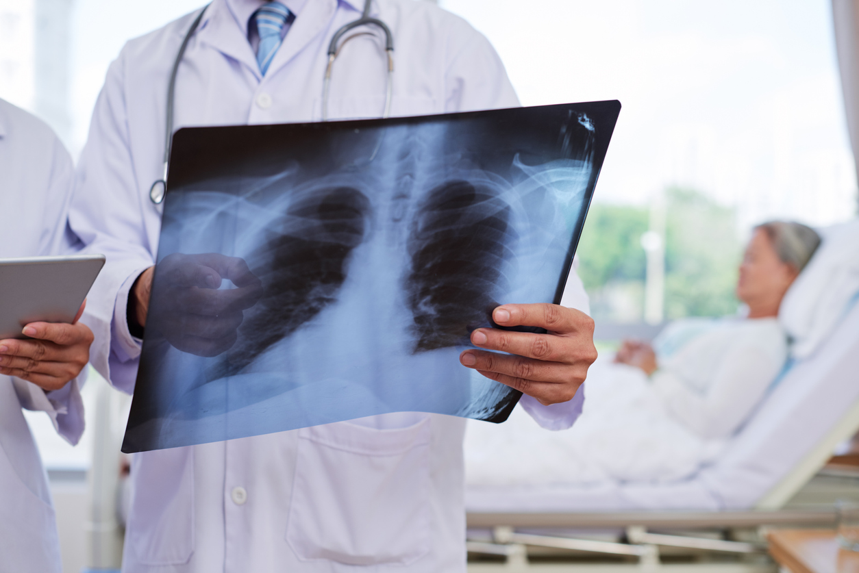 Chest Injuries After a Car Accident in Manassas, VA - The Parrish Car ...